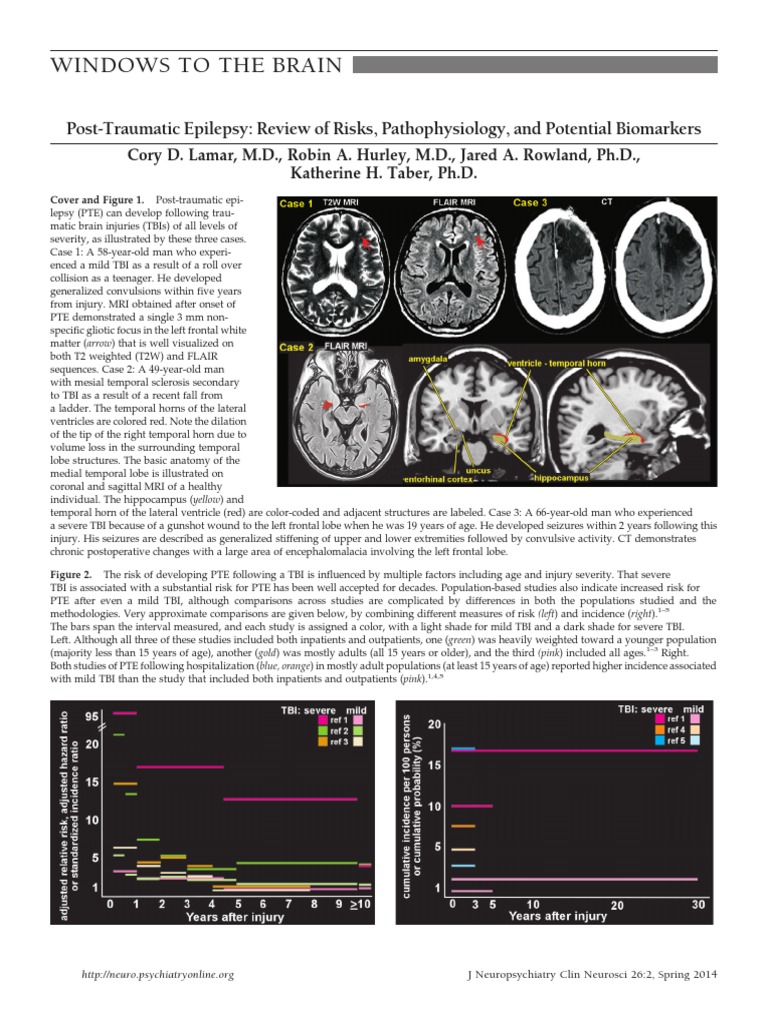 Post-Traumatic Epilepsy (JNCN 2014-Summer) | Download Free PDF ...
