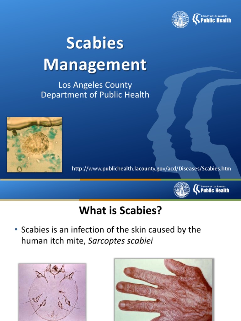 Scabies MGMT PP T | PDF | Epidemiology | Medical Specialties