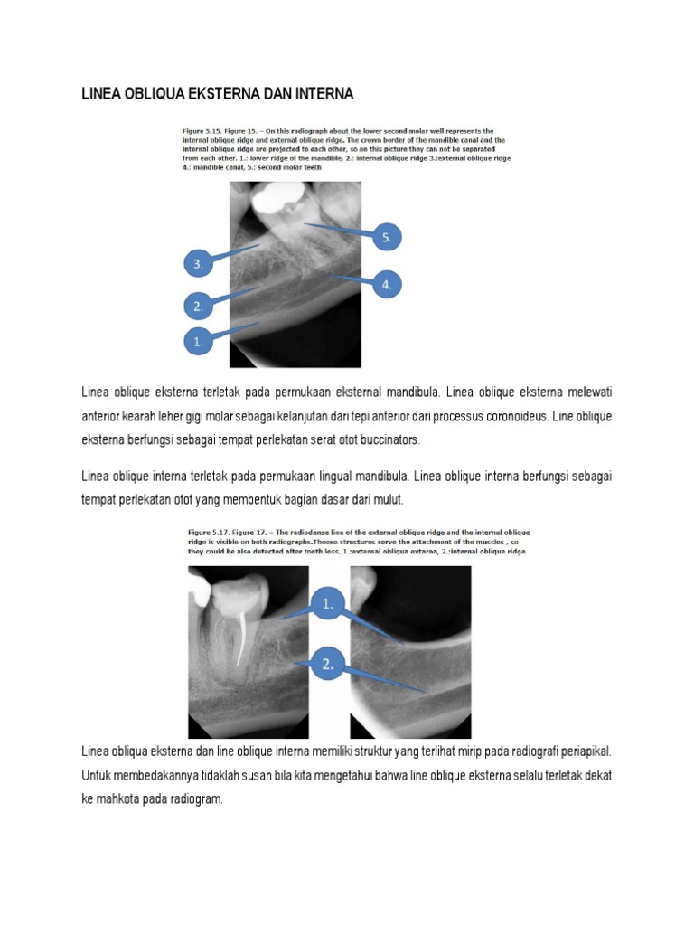 Struktur Linea Oblique Mandibula | PDF | Kajian Bahasa Asing