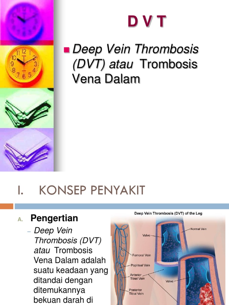 Deep Vein Thrombosis (DVT) Atau Trombosis: Vena Dalam | PDF | Sains ...