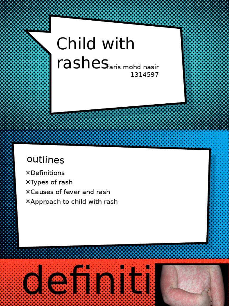 Seminar PAEDS Rashes | PDF | Immunology | Clinical Medicine