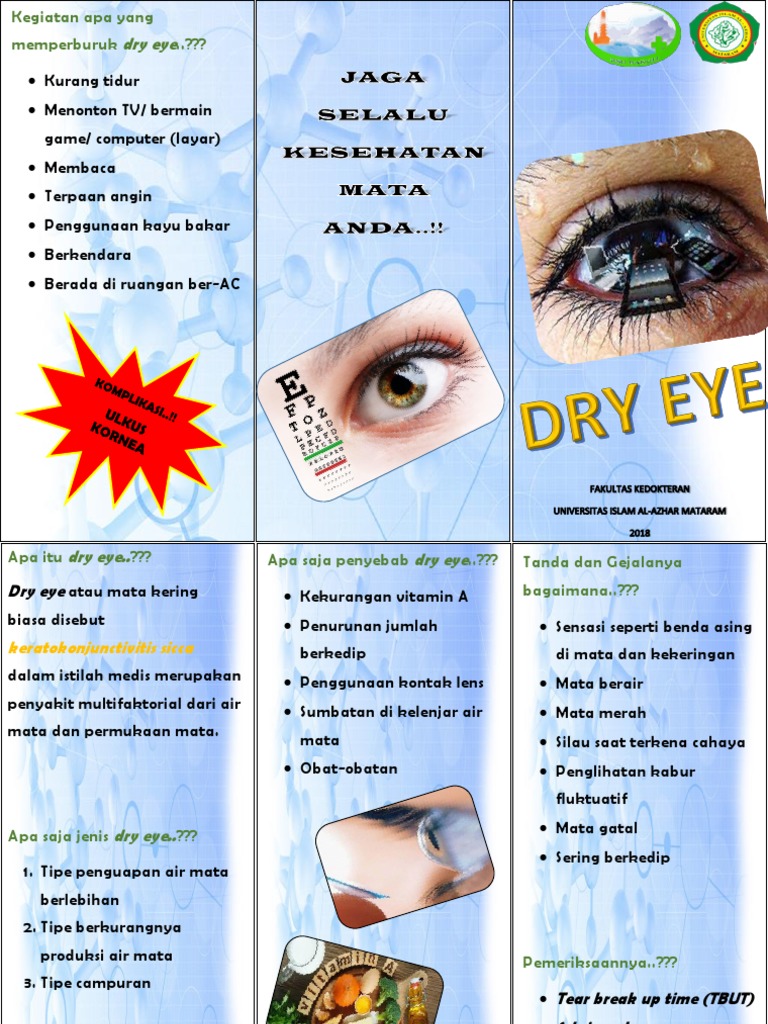Dry Eye | PDF