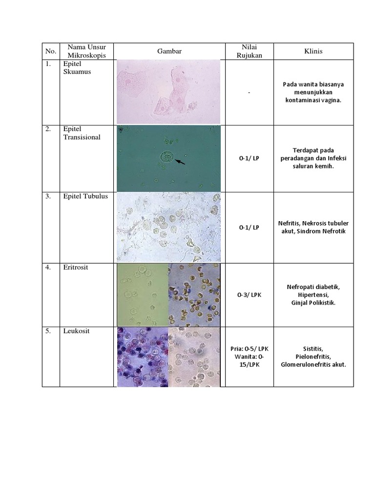 Analisis Unsur Mikroskopis Urin | PDF