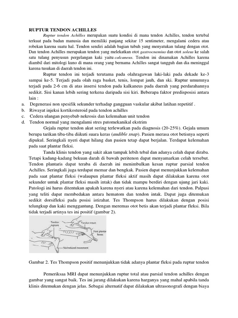 Ruptur Tendon Achilles | PDF