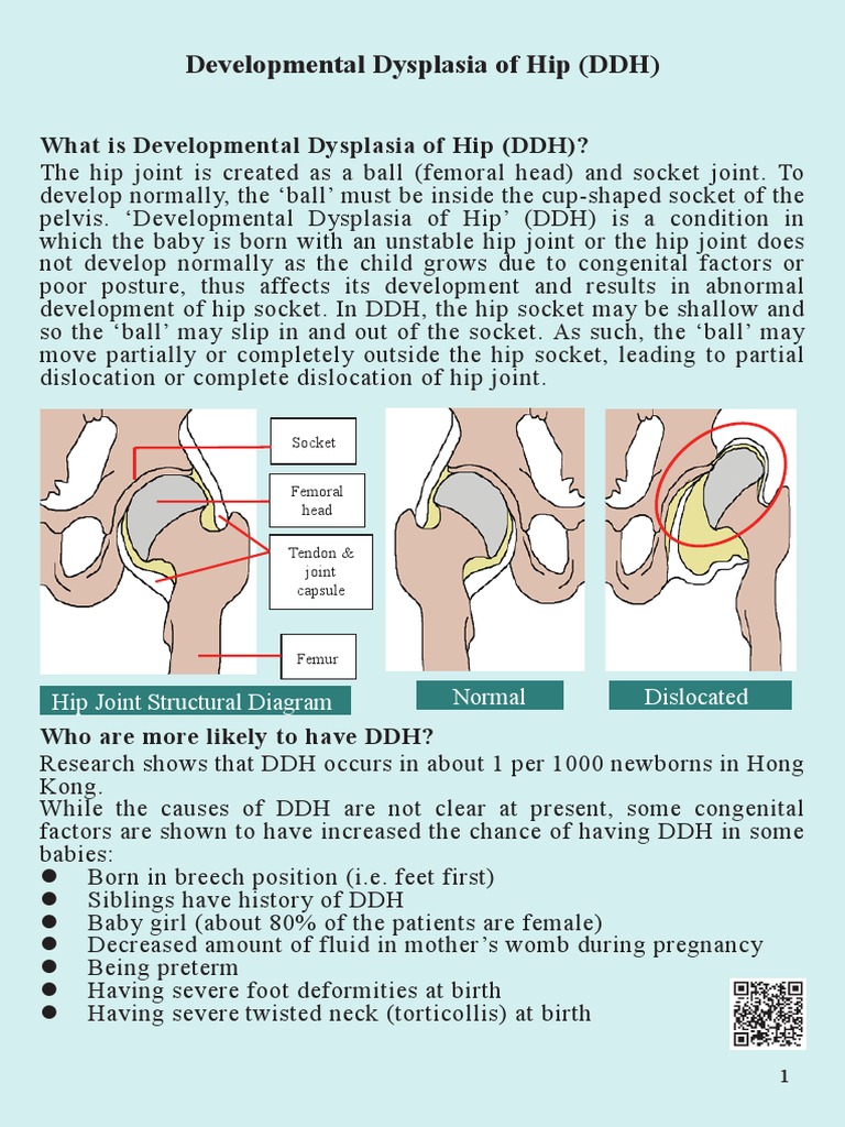 What Is Developmental Dysplasia of Hip (DDH) ? | PDF | Hip ...