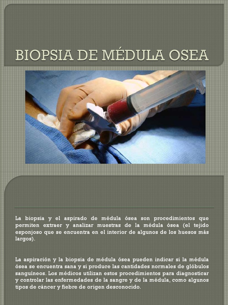 Biopsia de Médula Ósea | PDF