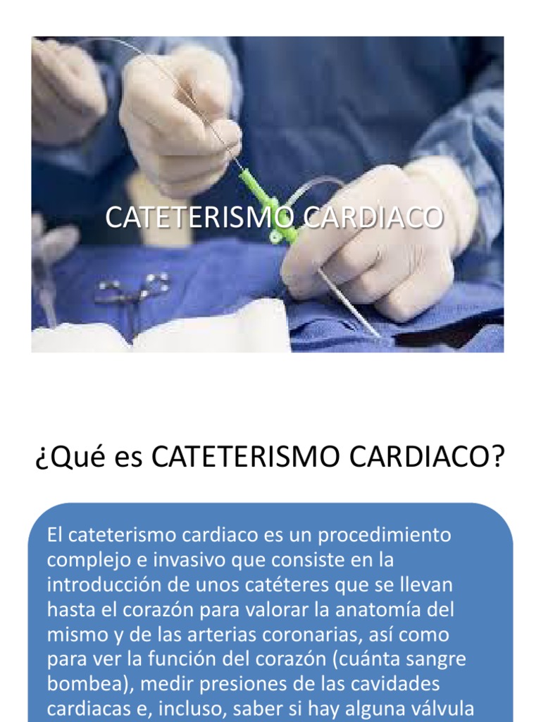 Cateterismo Cardiaco | PDF | Corazón | Infarto de miocardio