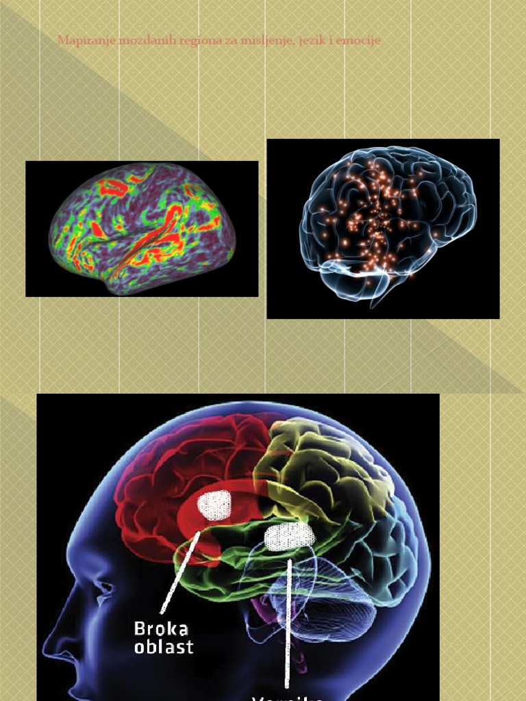 Dijagnostika I Tretman Afazija 2 | PDF