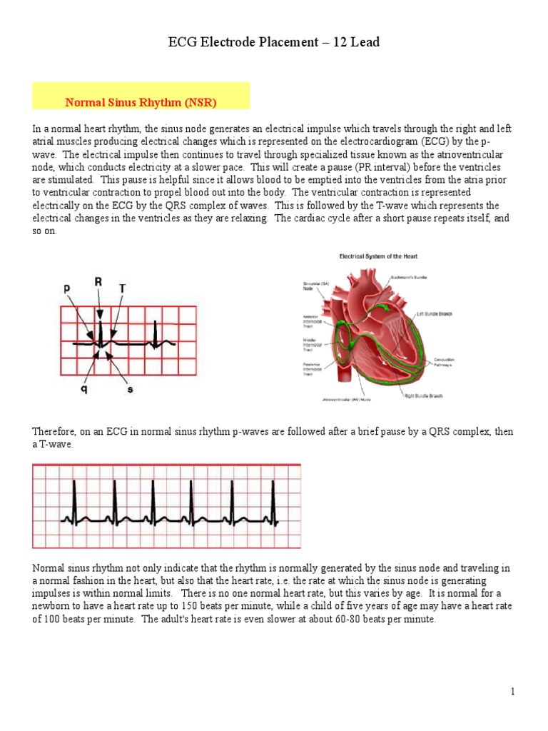 ECG Electrode Placement | PDF | Electrocardiography | Heart