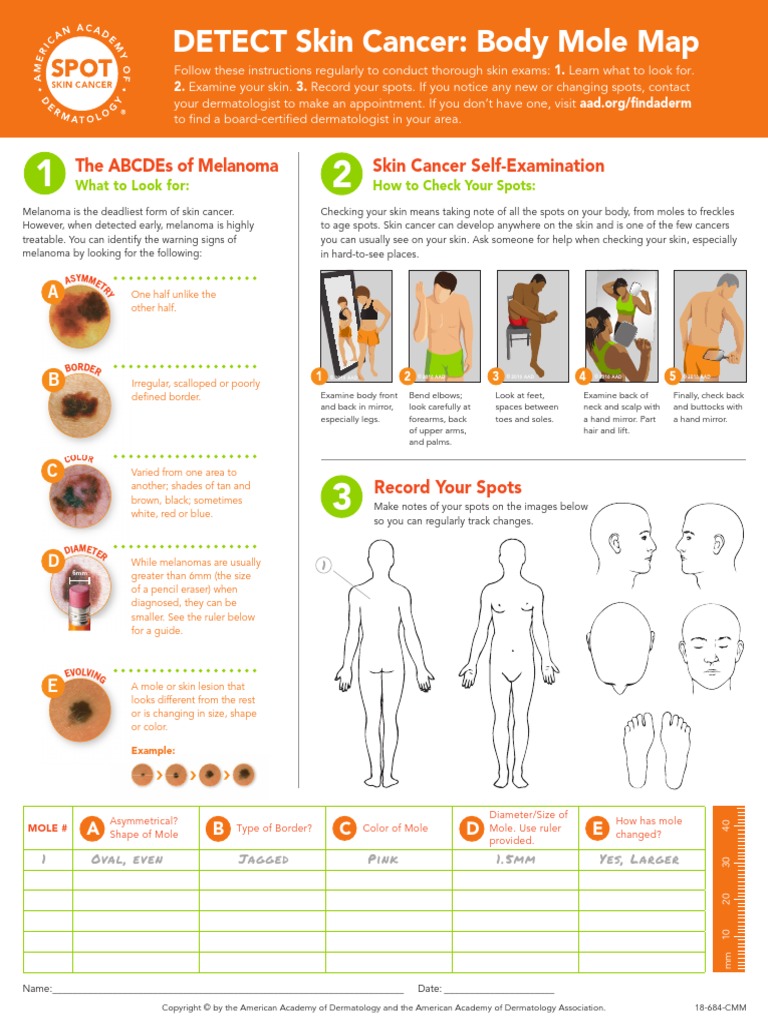 Moles Skin Cancer Aad-Body-Mole-Map PDF | PDF | Sunscreen | Skin Cancer