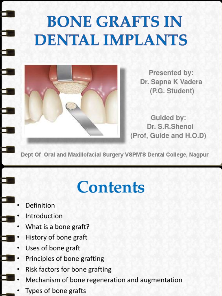 Defectos Óseos - Diagnóstico Radiográfico" | PDF | Osteoblast | Dental ...