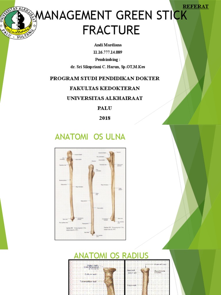 Management Green Stick Fracture | PDF