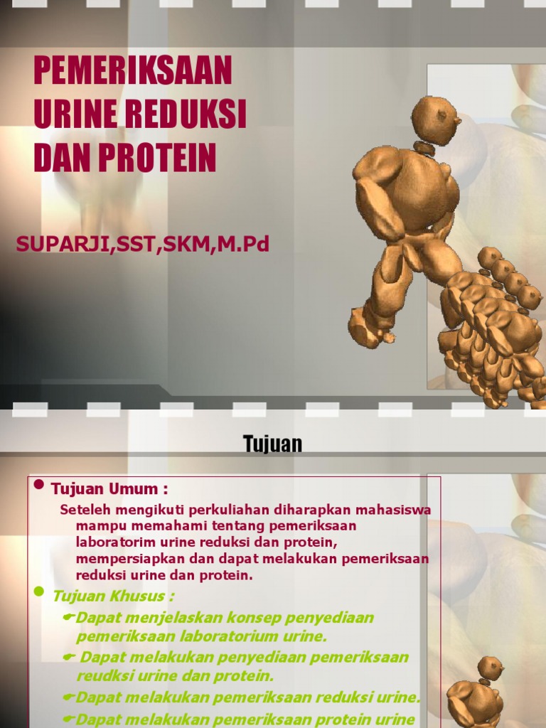 Pemeriksaan Urine Reduksi Dan Protein | PDF