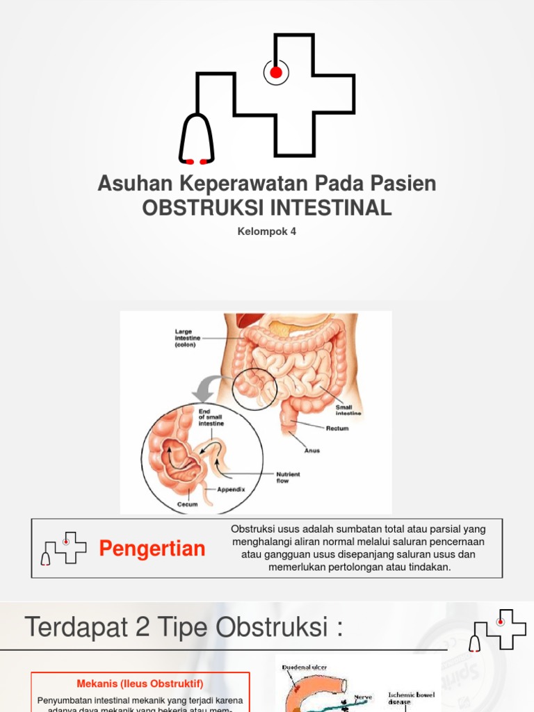 T11 - Obstruksi Usus Ileus | PDF | Sains & Matematika