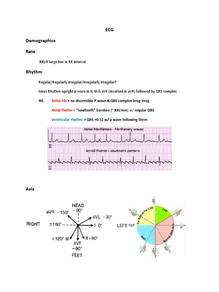 ECG Demographics Rate: 300/# Large Box in RR Interval | PDF ...