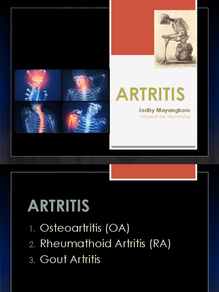Art Ritis | PDF