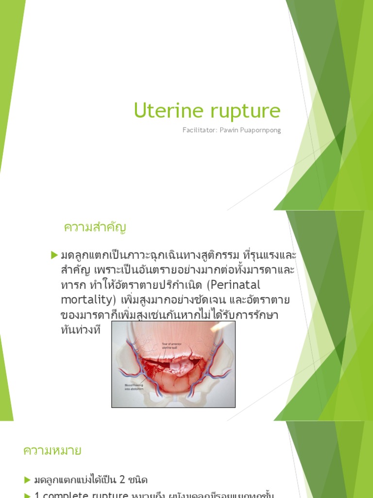 Uterine Rupture | PDF
