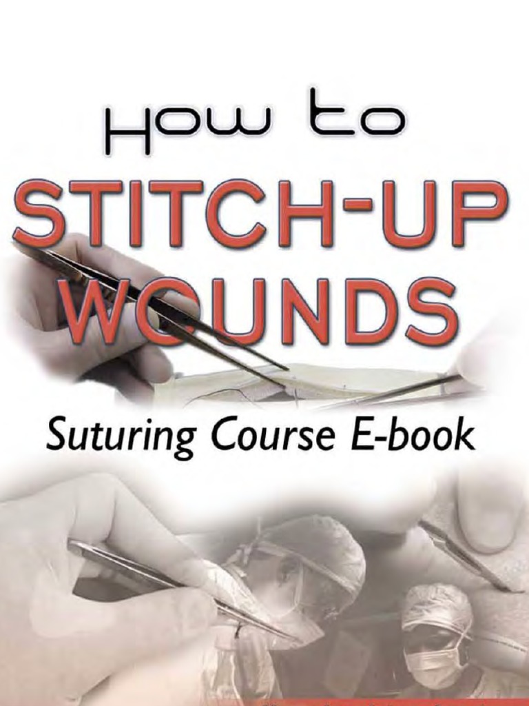 How - To.stitch Up - Wounds | PDF | Surgical Suture