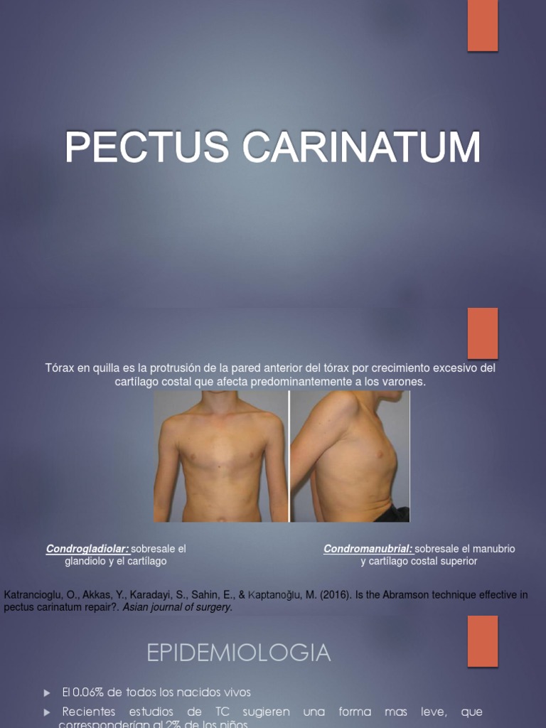 Pectus Carinatum: Causas y Tratamientos | PDF | Especialidades Medicas ...