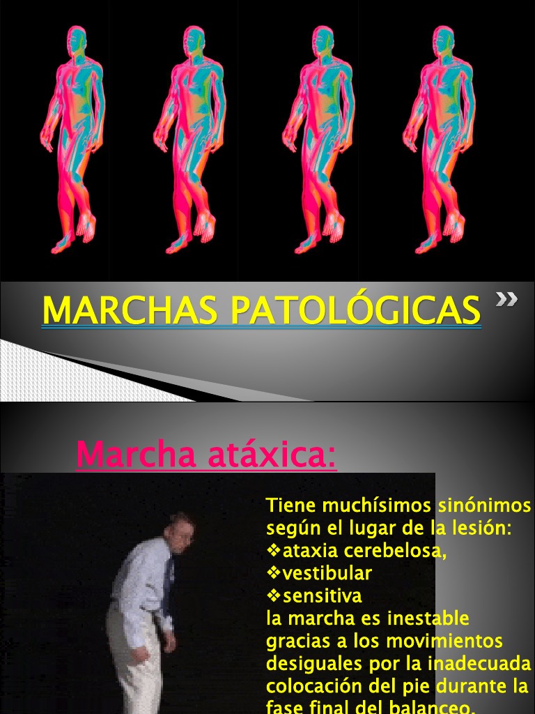 Marchas Patologicas | PDF | Distonia | Pie