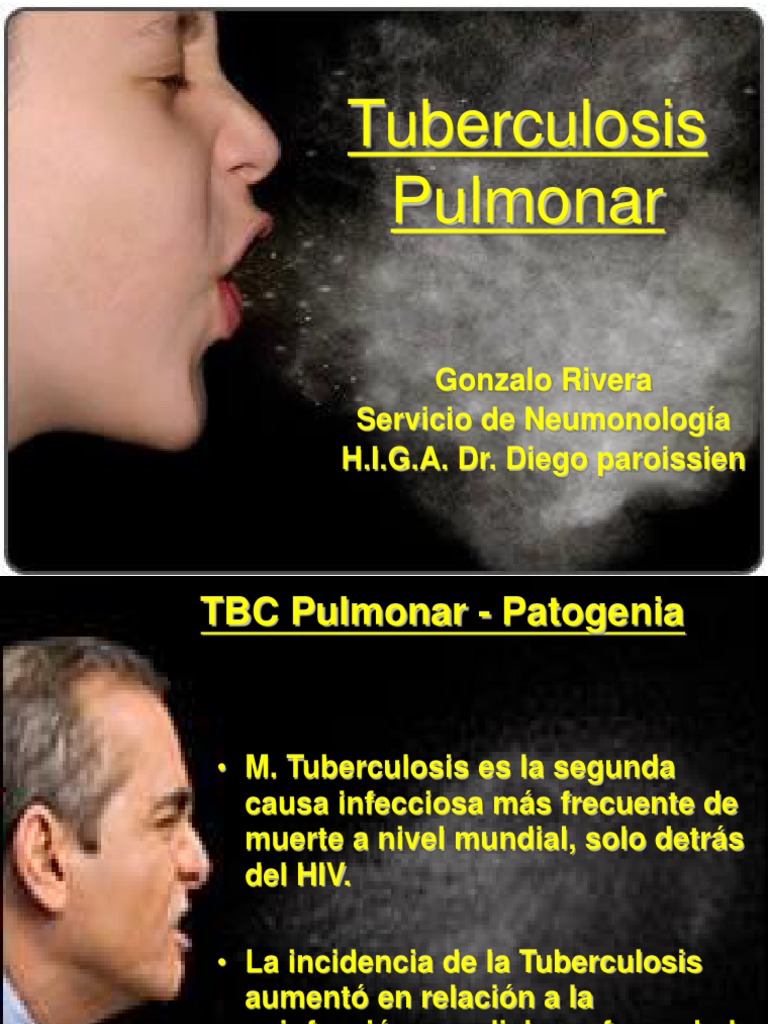 Tuberculosis Pulmonar | PDF | Tuberculosis | Epidemiología