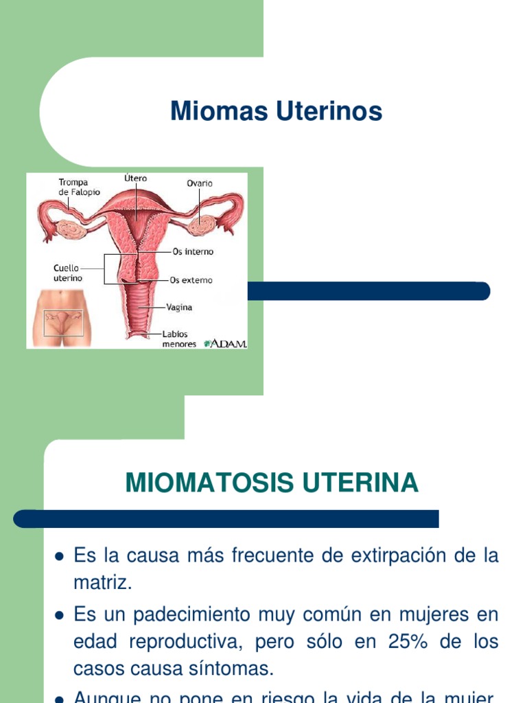 Miomas Uterinos Ok-1 | PDF | El embarazo | Parto