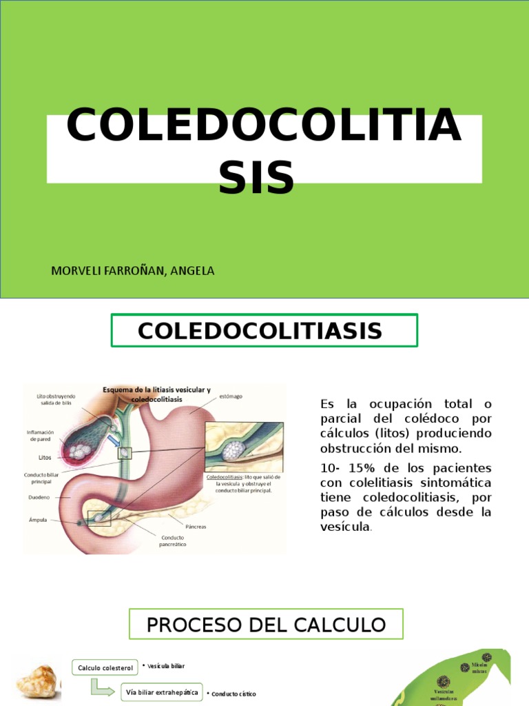 COLEDOCOLITIASIS | Vesícula biliar | Gastroenterología