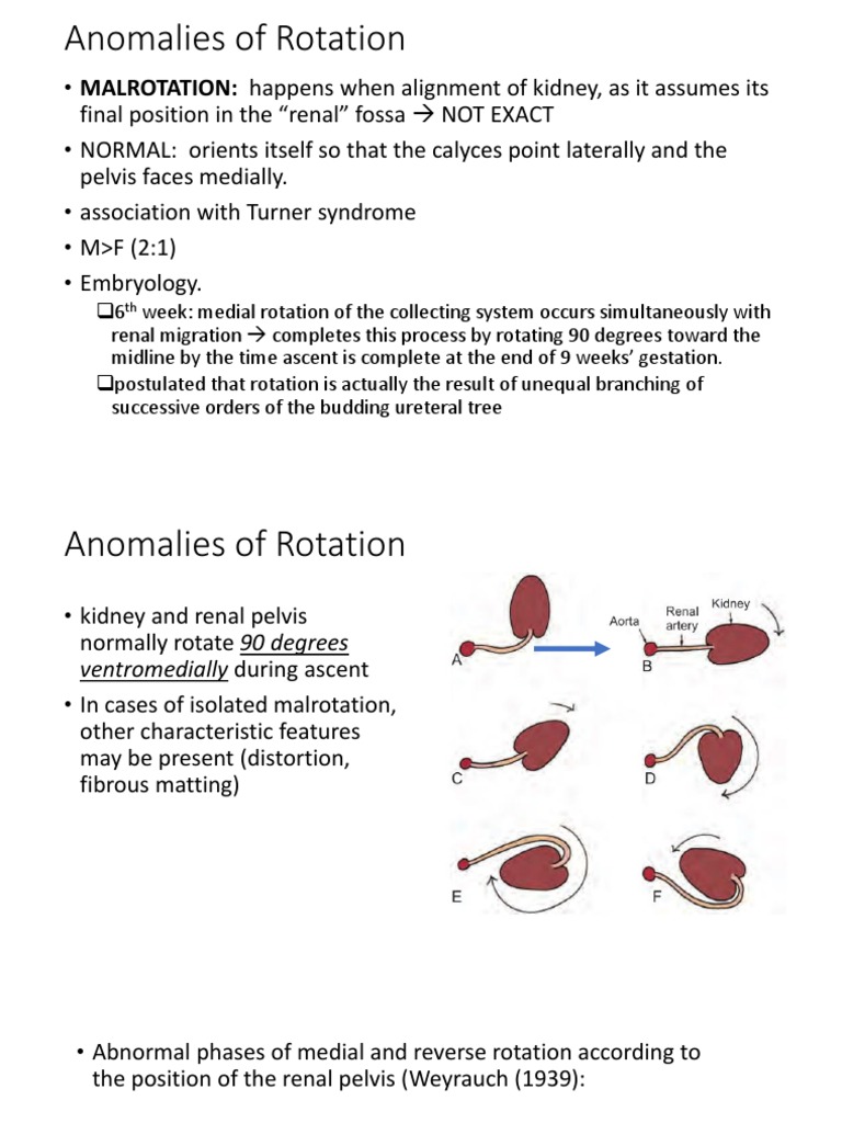 Anatomy and Embryology of Renal Malformations: A Comprehensive Review ...