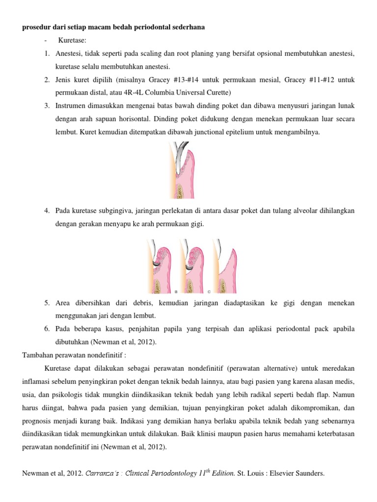 Prosedur Kuretase | PDF