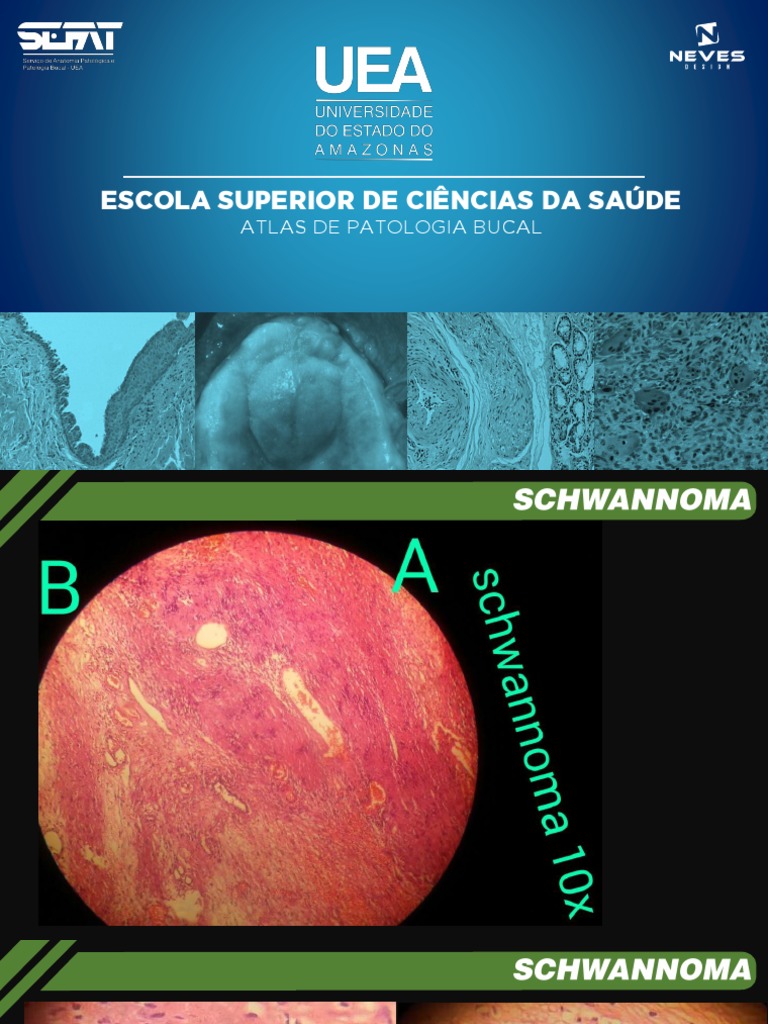 Atlas Patologia Bucal - UEA | PDF