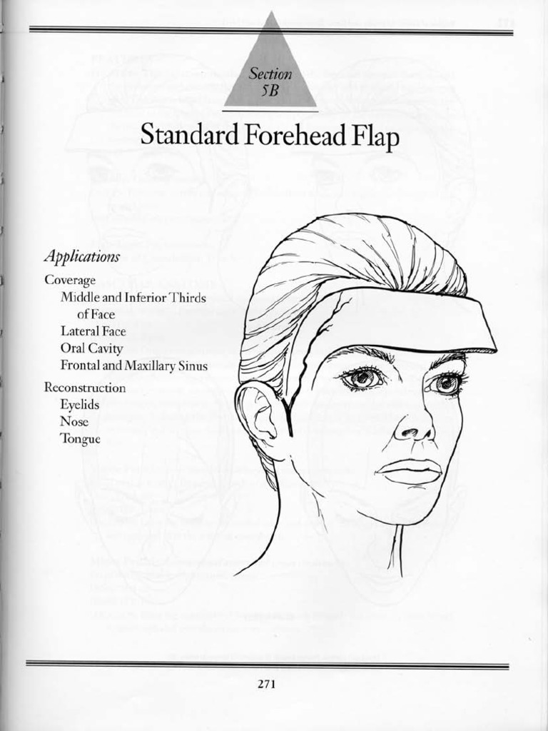 5B - Standard Forehead Flap | PDF