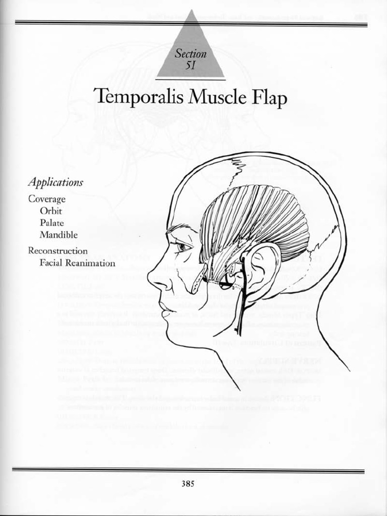 5I - Temporalis Muscle Flap