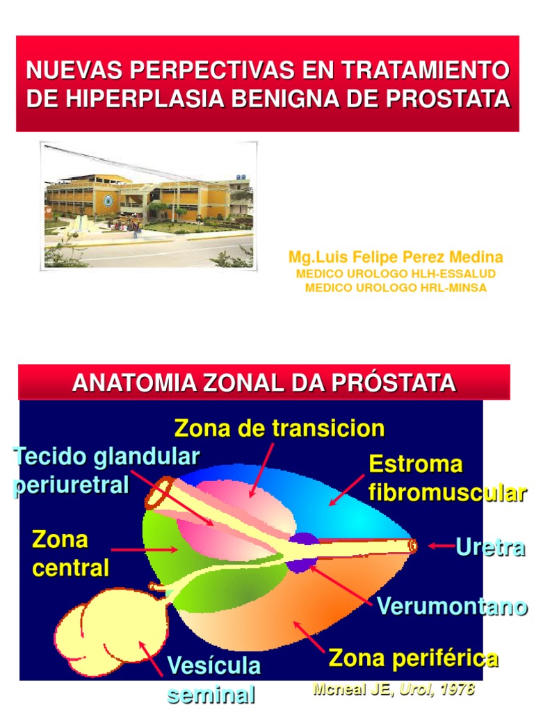 CLASE EXTRA Hipertrofia Prostatica Benigna | Antígeno específico de la ...