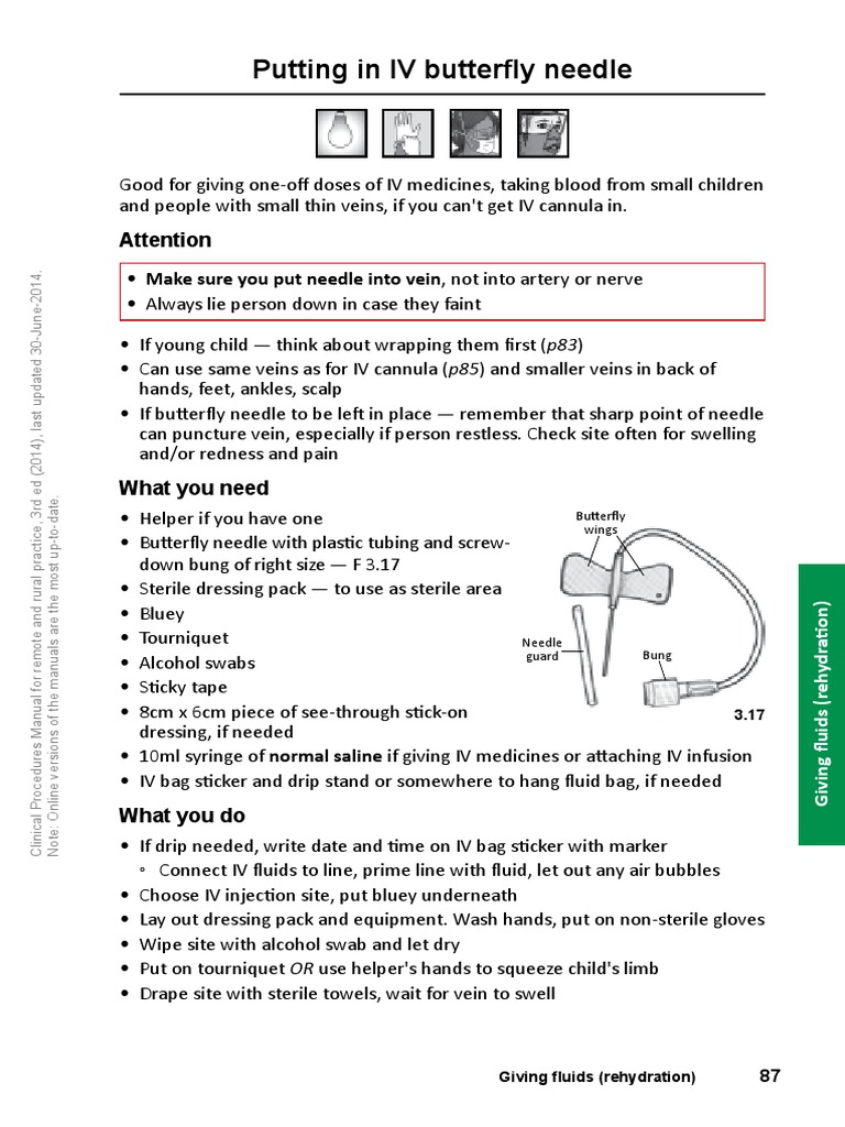 IV Butterfly Needle Insertion Guide | PDF | Intravenous Therapy ...