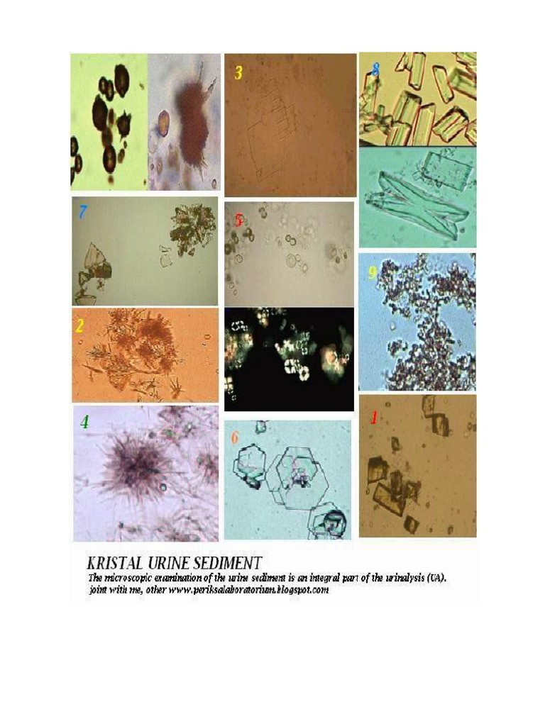 Gambar Sedimen Urine | PDF