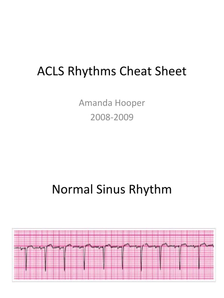 ACLS Rhythms Cheat Sheet