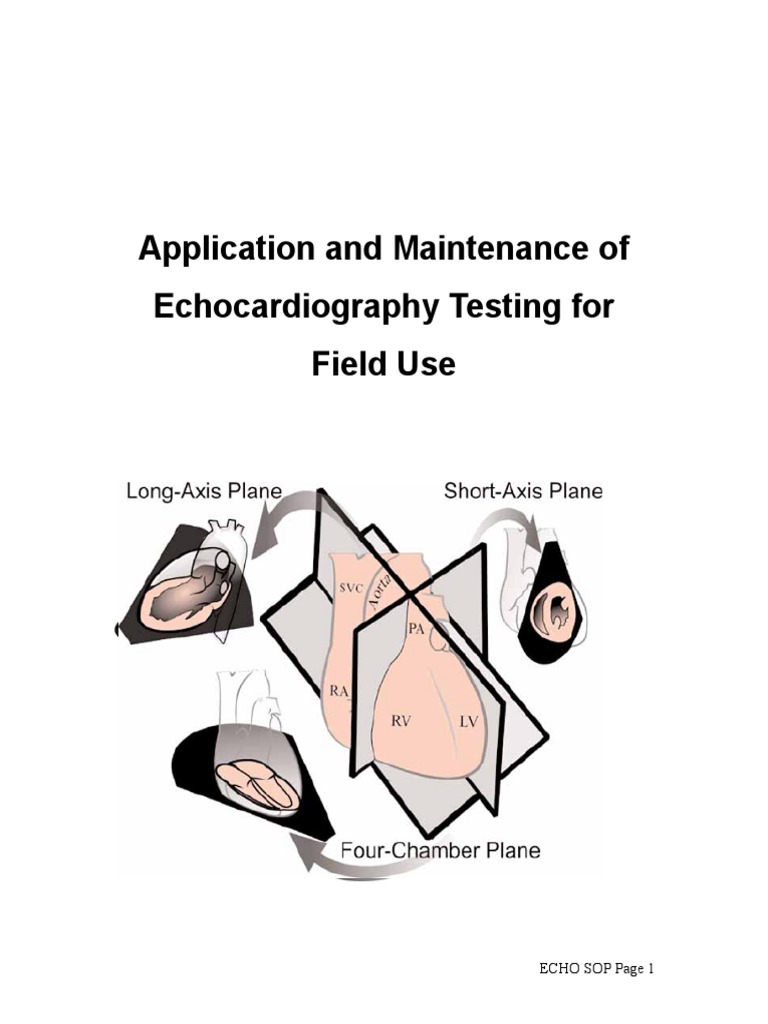 Cms-Sop Echo v5 23 Nov 2010 (JDS) Clean | Download Free PDF | Heart ...