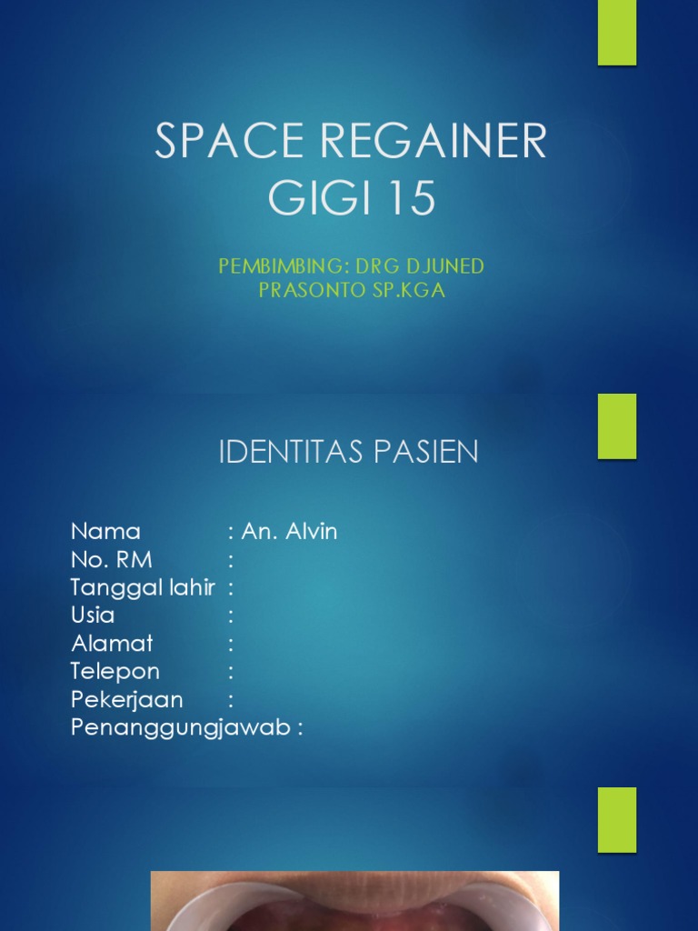 Space Regainer | PDF