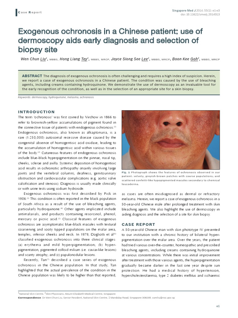 10 Exogenous Ochronosis in A Chinese Patient Use of | PDF | Dermatology ...