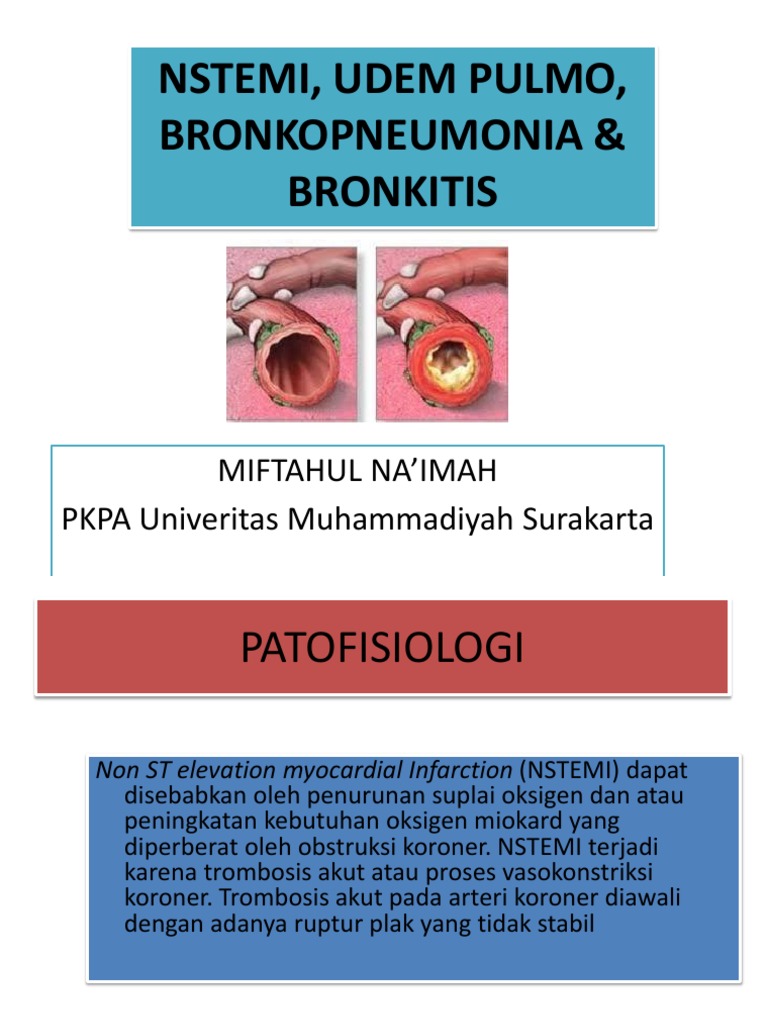 Terapi Pendukung untuk Bronkitis | PDF