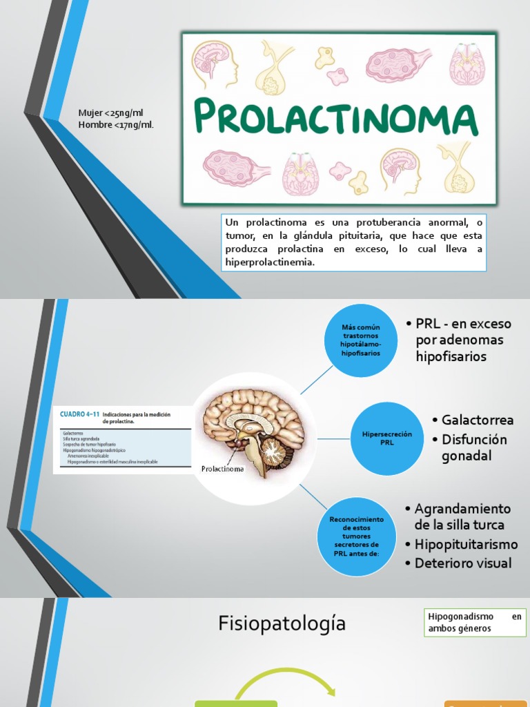 Prolactinoma | PDF | Hormona luteinizante | Sistema reproductivo