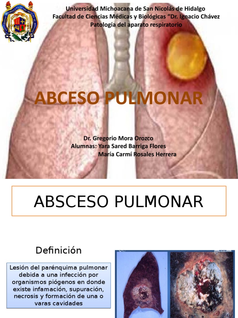 Absceso Pulmonar | PDF | Tos | Enfermedades y trastornos