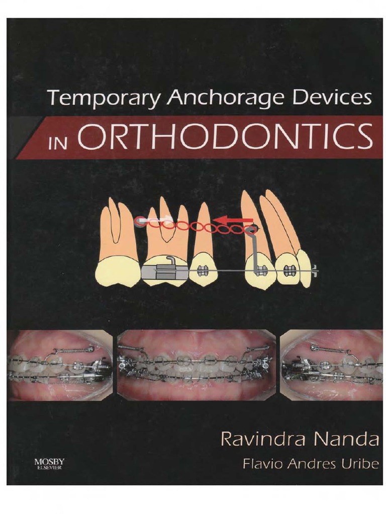 Temporary Anchorage Devices - Nanda | PDF | Dental Implant | Dental Degree