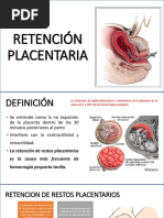Episiotomía y Episiorrafia | PDF | Parto | Medicina CLINICA