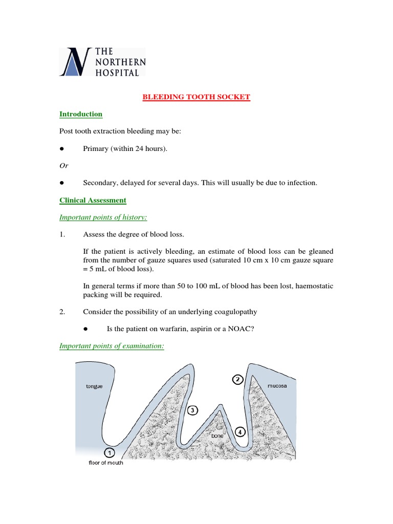 Bleeding Tooth Socket 1307 | PDF | Bleeding | Health Sciences
