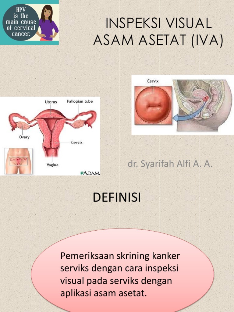 Inspeksi Visual Asam Asetat (Iva)