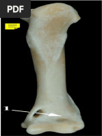 Humero Bovino Medial | PDF