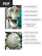 Anatomi Rangka Aksial Dan Apendikular | PDF