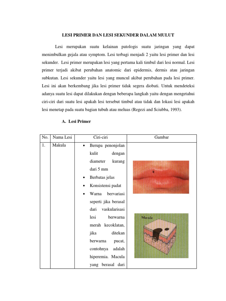 Lesi Primer dan Sekunder Rongga Mulut | PDF