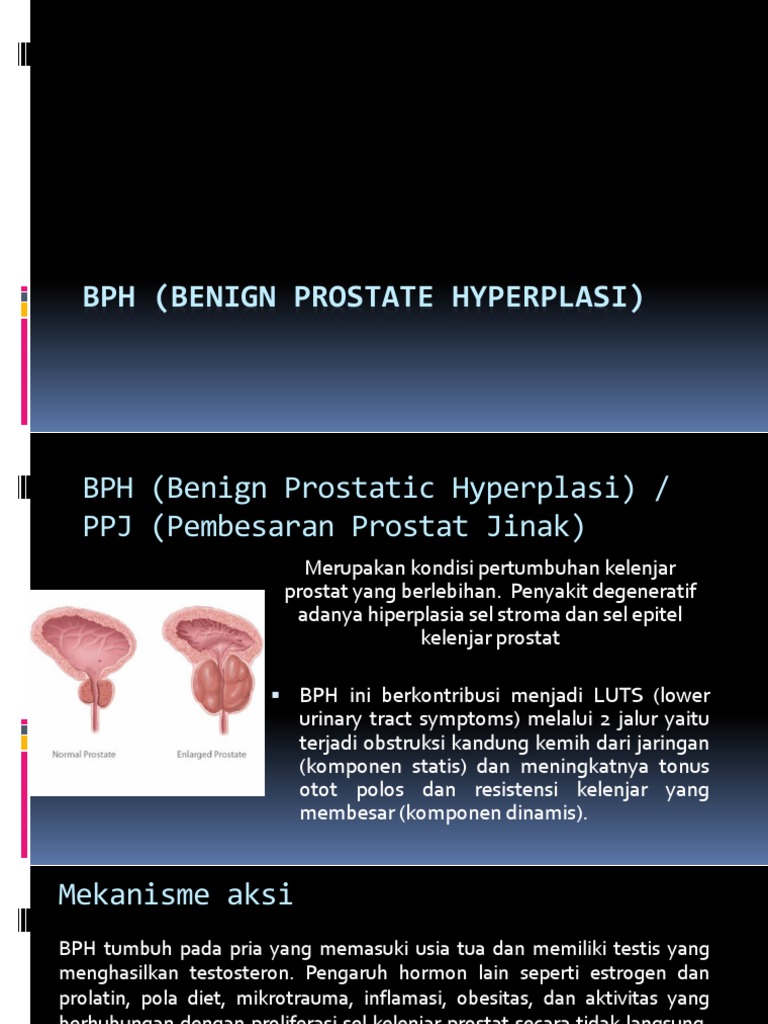 BPH (Benign Prostate Hyperplasi) | PDF